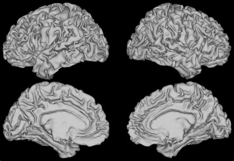 The Cifti Data Structure In R