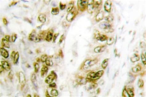 Invitrogen Phospho Irf3 Ser385 Polyclonal Antibody 100 μl