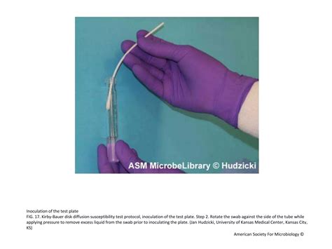 Kirby Bauer Disk Diffusion Susceptibility Test Pptx