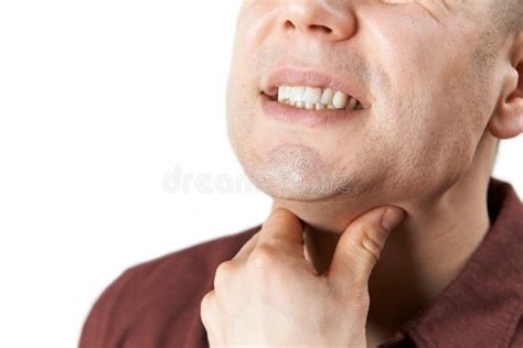 Sore Throat With Throat Swollen Closeup Open Mouth With Posterior Pharyngeal Wall Swelling And