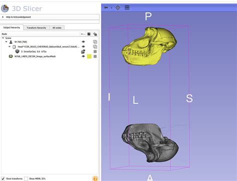 aligning a surface model and volume rendering of the same skull
