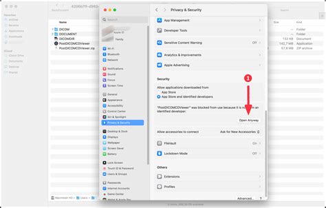 Cd Viewer Usage For Macos Sonoma Postdicom Knowledge Base