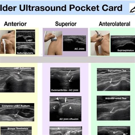 Pocus 101 On Instagram New Pocus 101 Blog Post On Shoulder Ultrasound