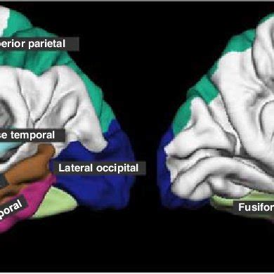 AC Anterior Cingulate The Software Enables Surface Division Into 34 Download Scientific