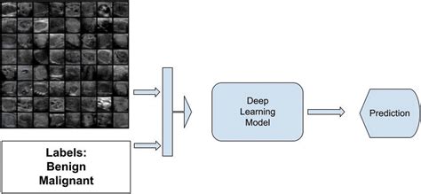 Artificial Intelligence For Evaluation Of Thyroid Nodules A Primer