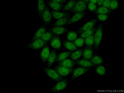 Chd9 Antibody 13402 1 Ap Proteintech