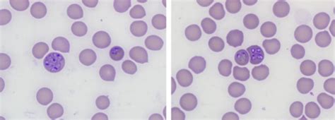 Protozoa Lab Flashcards Quizlet