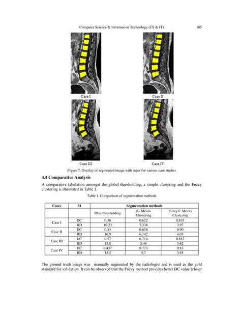 Segmentation And Labelling Of Human Spine Mr Images Using Fuzzy Clustering Pdf