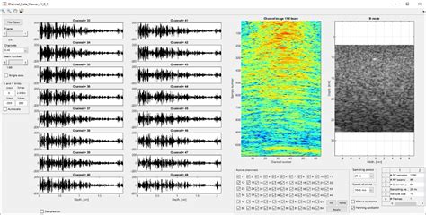 Telemed Research Channel Rf Data