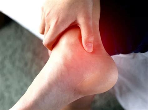 4 Dấu Hiệu đau Cổ Chân Cảnh Báo Là Do Bệnh Gout