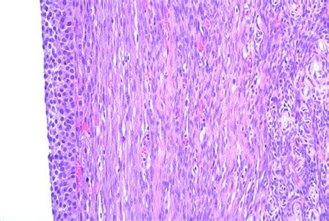 Female Genital Pathology Understanding Cell Forms