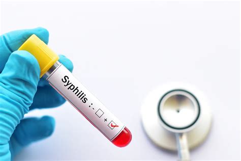 How Long Is Syphilis Contagious After Treatment Lifemd