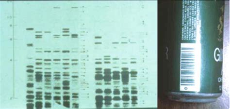 Forensic DNA Typing Basicmedical Key