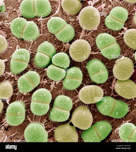 Algae Coloured Scanning Electron Micrograph Sem Of Single Celled Algae Green Magnification