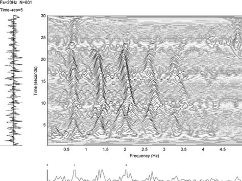 B Distribution Of The Time Frequency Peak Filtered Newborn Eeg Signal Download Scientific Diagram