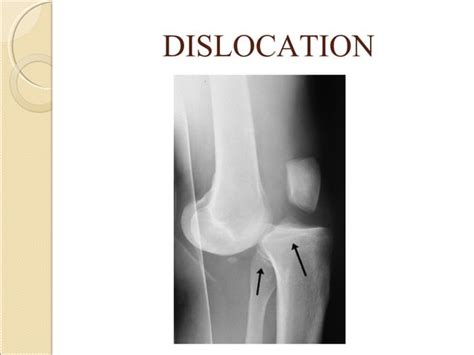 Basics Of Orthopedic Radiology Ppt