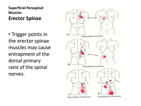 Differential Diagnosis Of Chronic Low Back Pain Ppt Download