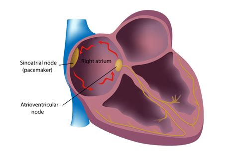 Topic Atrial Flutter 12 Lead Ecg Course Acls Certification