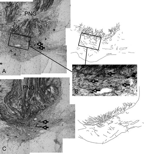 Reconstruction Of Axonal Outgrowth From Pn Grafts Exposed To Bda The