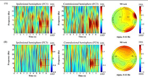 Figure 3 From Relation Between Sensorimotor Rhythm During Motor Attemptimagery And Upper Limb