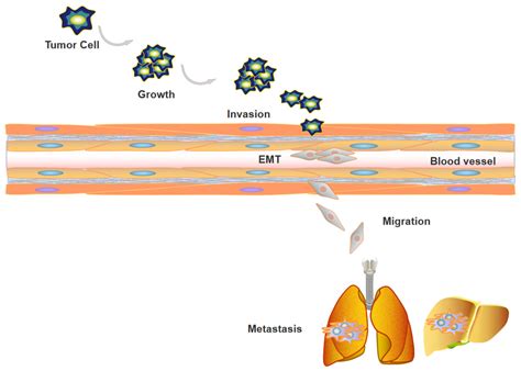 The Role Of Foxp3 On Tumor Metastasis And Its Interaction With Traditional Chinese Medicine