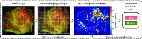 The Process For Margin Level Binary Prediction Tumor Vs Normal A