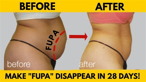 Causes And Solutions For Fupa What Is Fupa Here Is How To Reduce Fat