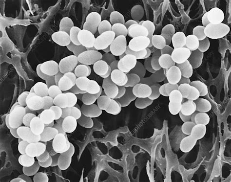 Staphylococcus Aureus Sem Stock Image C037 0173 Science Photo Library