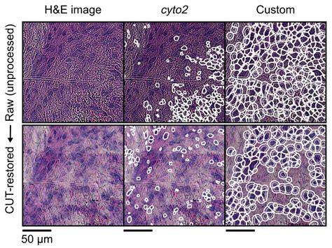 Pairwise Alignment Open St