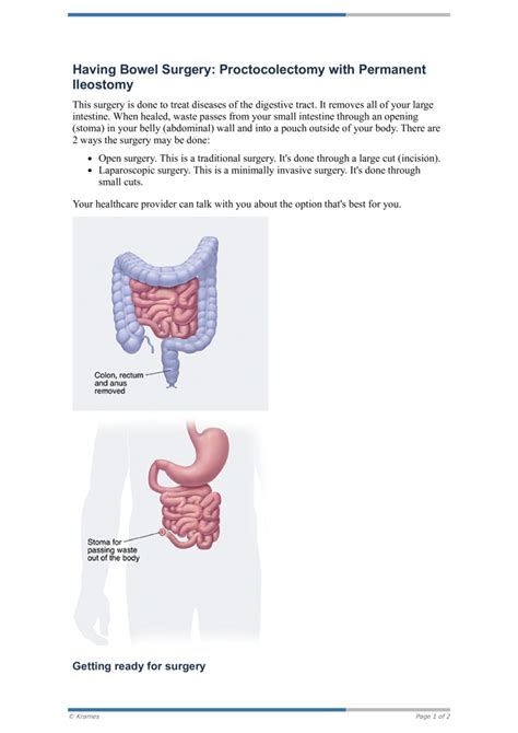 PDF Having Bowel Surgery Proctocolectomy With Permanent Ileostomy HealthClips Online