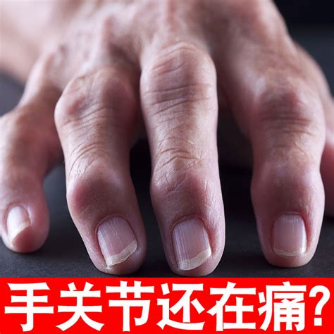 手指头囊肿图片 手指血管瘤图片大人 伤感说说吧