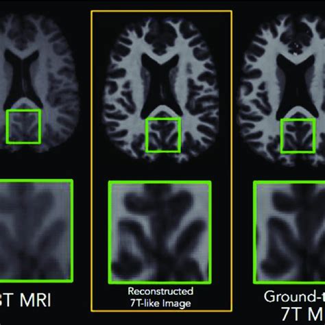 Radiotherapy Workflow From Patient Consult And Assessment To Follow Up Download Scientific