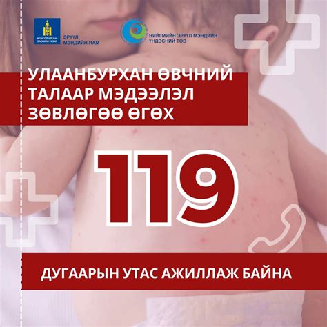 Нийгмийн 👉Иргэн та улаанбурхан өвчний талаар болон эрт илрүүлэгтэй холбоотой зөвлөгөө