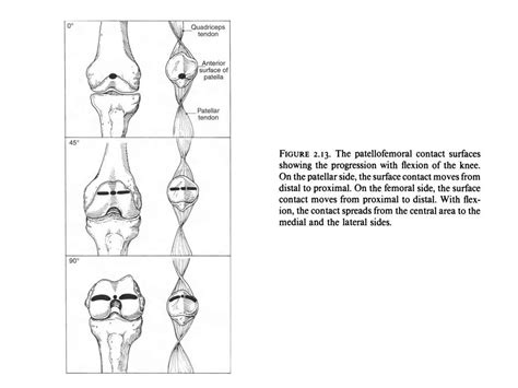 Patella Dislocations Pptx Patella Dislocations Pptx