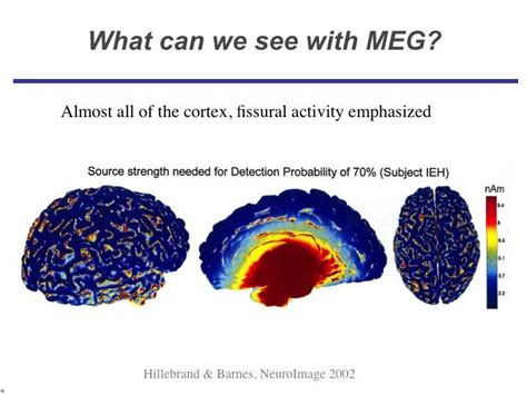 What Is Magnetoencephalography Meg Institute For Learning And Brain Sciences I Labs