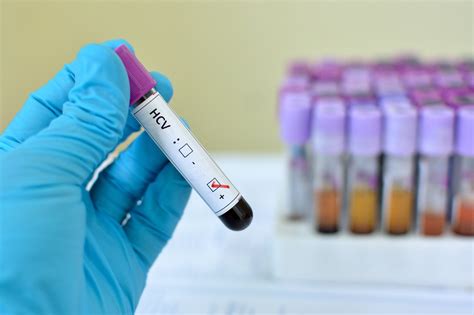 Hep C HIV Users News UN