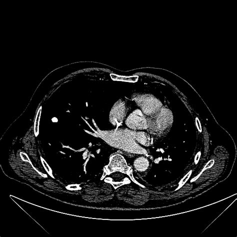 SimpleITK的使用 知乎
