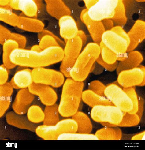 E Coli Bacteria Coloured Scanning Electron Micrograph Sem Of Escherichia Coli Bacteria