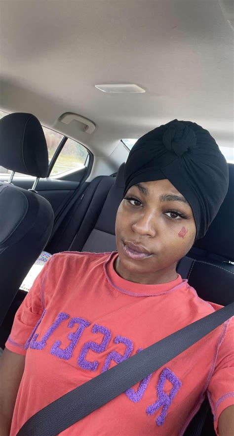 Around 4 Weeks Post Op Ffs R Transgender Surgeries
