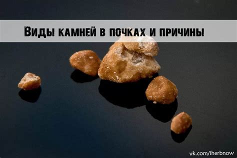 Влияние Ph на камни в почках причины формирования