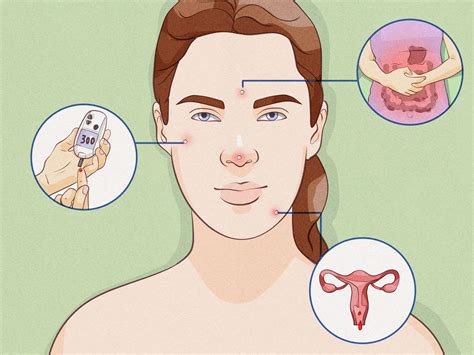 Does A Nose Pimple Mean Someone Likes You Truths And Myths