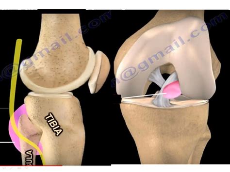 Ganglion Cysts Around The Knee Joint —