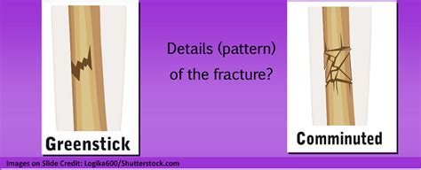 Bone Fractures Nclex Review