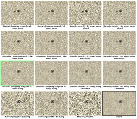 Design And Implementation Of Defect Detection System Based On Yolov5 Cbam For Lead Tabs In