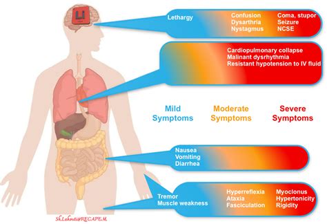 Lithium Toxicity RECAPEM