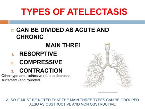 Atelectasis Pptx