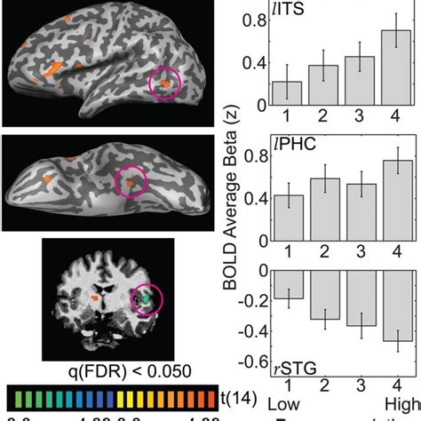 Posterior Occipito Temporal Regions Of Cortex Show Linear Deflections Download Scientific