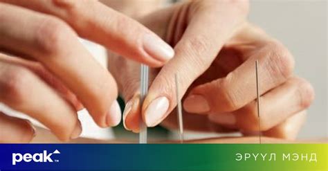 Эмчлэх эрхгүй хүнээр төөнүүр хийлгэсэн иргэний бие мууджээ Peak News