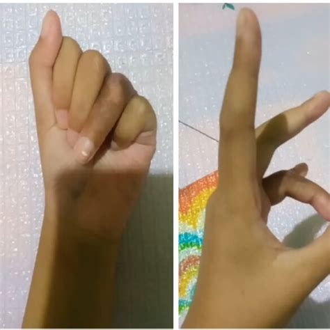 Postoperative Improvement In Functional Movement Of The Pip Joint Of Download Scientific