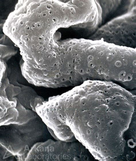 Extracted Immune Complexes From Biopsy Neuro Notes